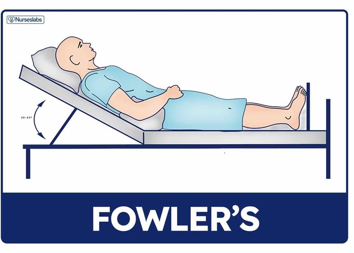 Immediately after log-rolling a client to a lateral posit | Nursing Exam