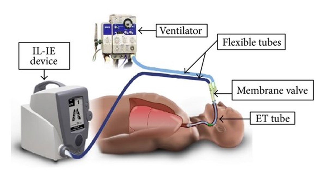 Review Exam 1 ICU Cardiac, Respiratory, Neuro, Renal, Shock/Skills