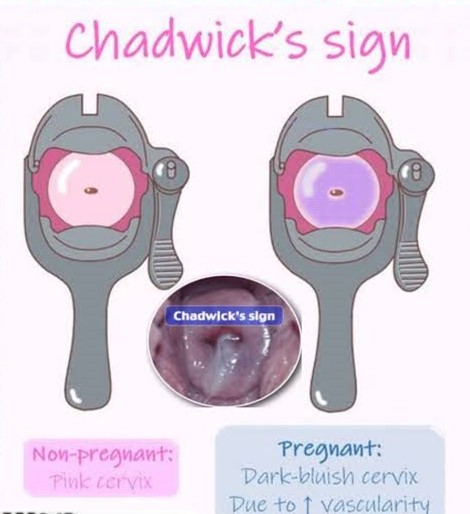 Review ATI Maternal Newborn III